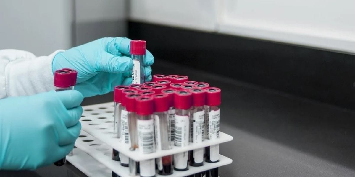 Extracci n De Sangre Pasos Que Realiza La Enfermera IFSES